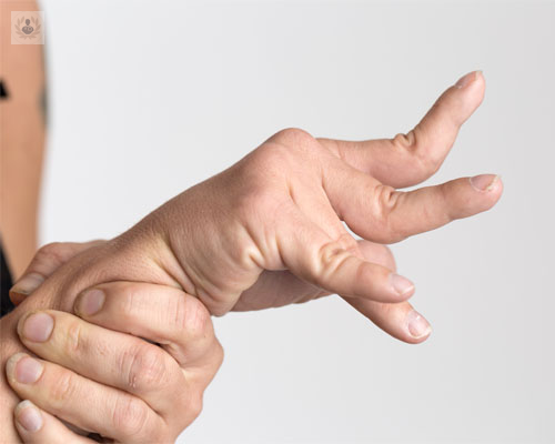 Cirugía de la Mano tetrapléjica | Top Doctors | Top Doctors