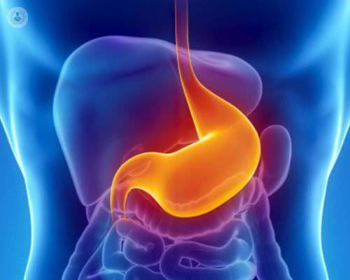 Que es el reflujo gastroesofágico sus síntomas y su tratamiento | Top ...